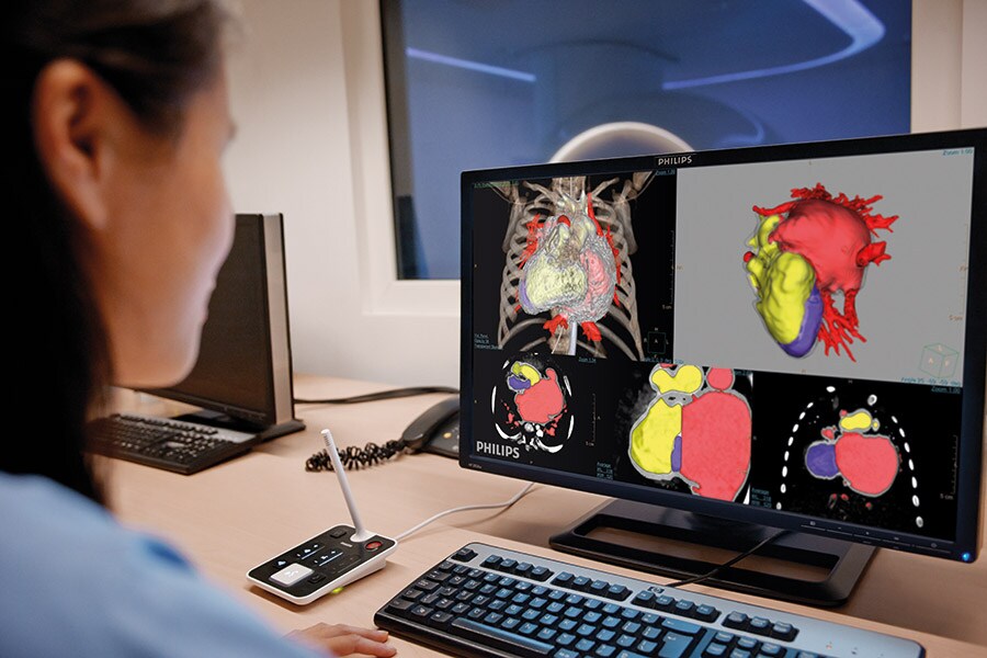 IntelliSpace PACS | Enterprise imaging PACS | Philips Healthcare