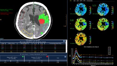 IntelliSpace Portal 9.0 | Radiology and cardiology diagnostic imaging ...